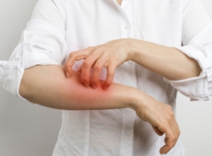 Food Allergies & Intolerances - Perfect Balance Rehabilitation Centre